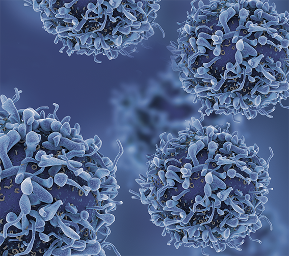 Zionexa USA and PETNET Solutions announce FDA approval of Cerianna ...